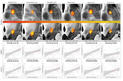 Hotspot Maps Of Areas Associated With Clinical Improvement In The