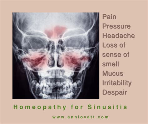 Homeopathy For Sinusitis A Natural Approach