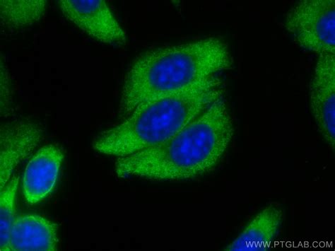 Serping1 C1 Inactivator Antibody Cl488 12259 Proteintech