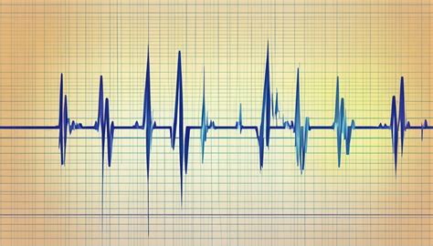 How Heart Block Ecg Diagnoses And Treatment Work
