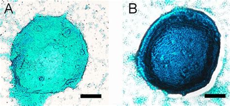Evolution Of Cartilage Repair Technology Intechopen
