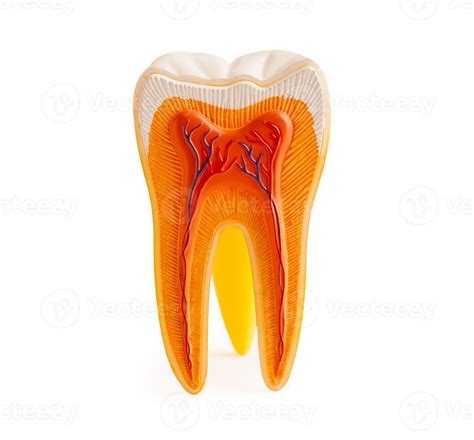 Dental Implant Root Canal Teeth Model For Education Isolated On White