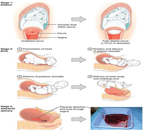 Vaginal Delivery Diagram