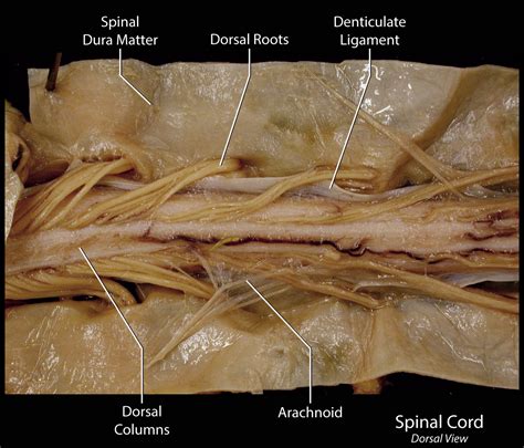 Denticulate Ligaments