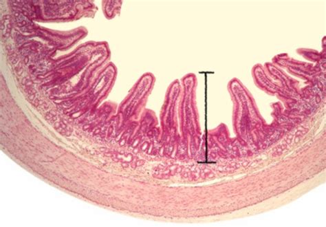 Histology Practical III Flashcards Quizlet