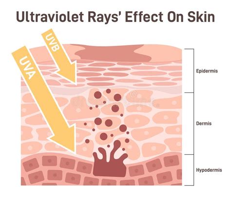 Efecto De Los Rayos Uv Sobre La Piel Uva Uvb Rays Atraviesa Las