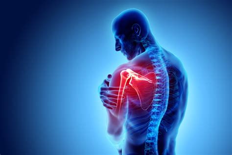 Frozen Shoulder Syndrome What It Is And How To Treat It Emergency Live