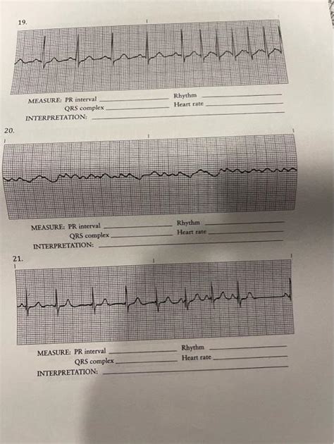 QRS Complex INTERPRETATION MEASURE PR Interval Chegg Com