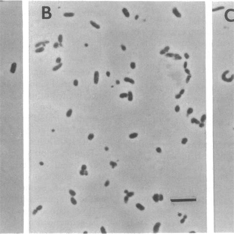 Phase Contrast Photomicrographs Showing The Morphology Of E Coli Cells