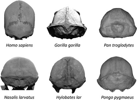 Visual Representation Of The Complexity Of Sagittal And Lambdoid