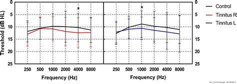 Effect Of Tinnitus On Sound Localization Ability In Patients With