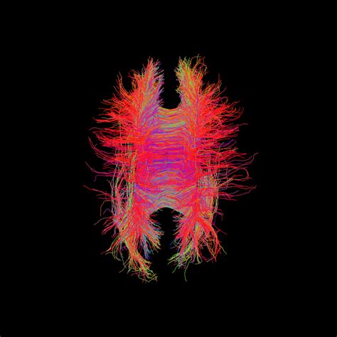 Dipy — Dipy 1110dev0git20241213932dcbd Documentation