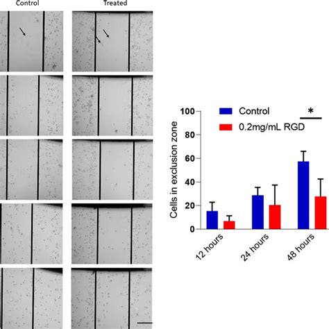 Blocking The Integrin Binding With 0 2 Mg Ml Rgd Reduces Microglial