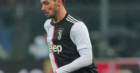 Infortunio De Sciglio è lesione muscolare i tempi di recupero