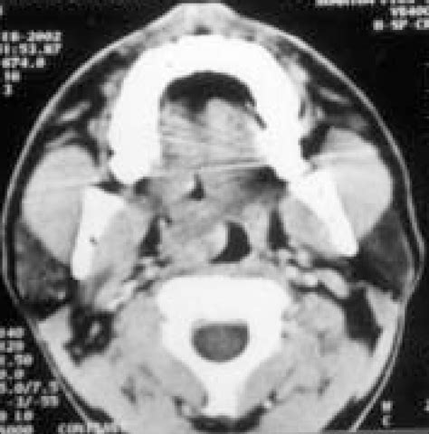 Ct Scan Axial Section Download Scientific Diagram