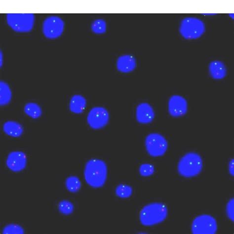 Representative Dual Color Fluorescence In Situ Hybridization Download Scientific Diagram