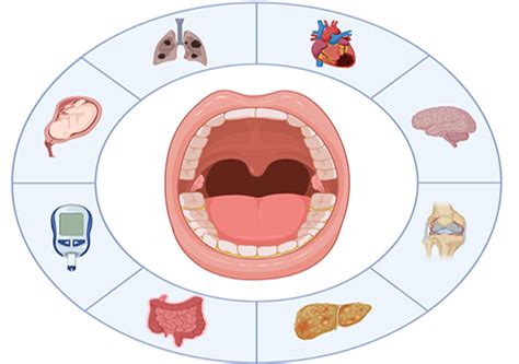 Jdr Special Issue The Relationship Between Oral And Systemic Diseases