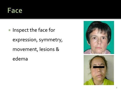 PPT Physical Assessment Head Neck And Skin PowerPoint Presentation