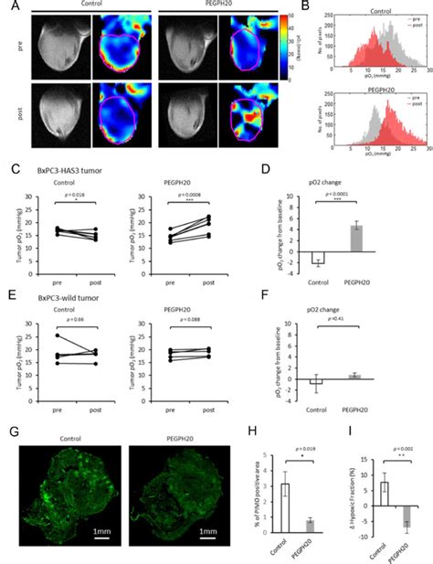 Pegph20 A Pegylated Human Hyaluronidase Induces Radiosensitization By