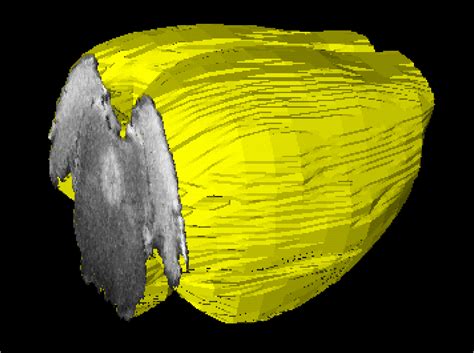table 1 1 from magnetic resonance image segmentation using pulse