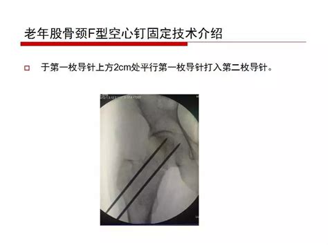 文章详情
