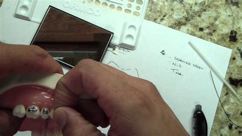 Orthodontic Bracket Placement 101 Youtube