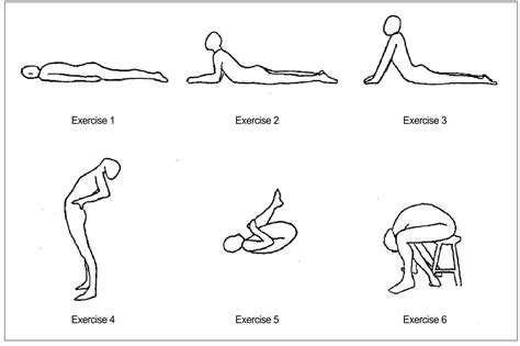 Mckenzie Exercises For Sciatica