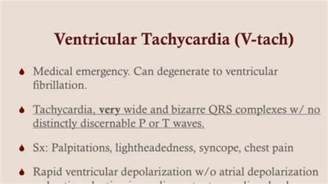 Ventricular Tachycardia Youtube