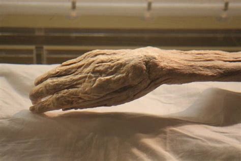 Xin Zhuis Lady Dai Mummy The Best Preserved Corpse In History