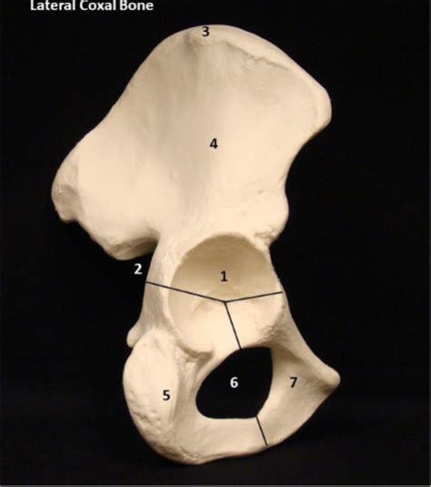 Lateral Coxal Bone Diagram Quizlet