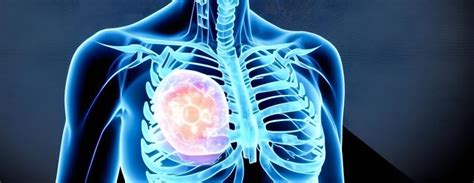 Fda Approved Ai Algorithm More Likely To Detect False Positive Breast Cancer Cases In Black