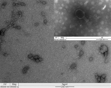 Transmission Electron Micrograph Of Bacteriophage Vbecom Ufv017 The