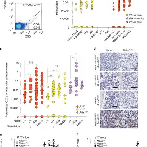 Nalcn Regulates P1kp Gac Proliferation And Morphology A Current
