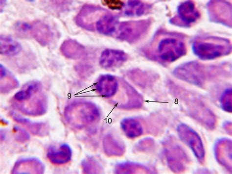 Plasma Cells Histology