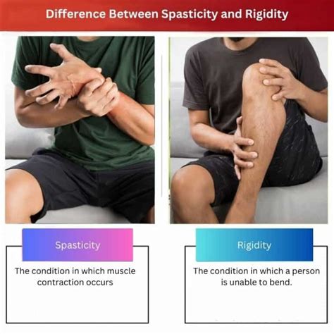 Spasticity Vs Rigidity Difference And Comparison
