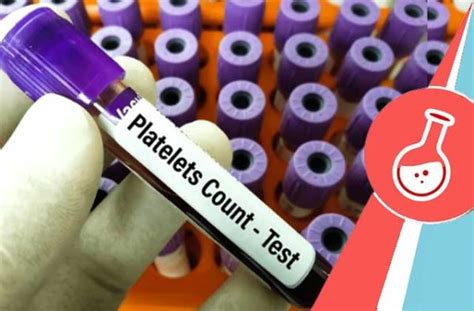 Understanding Platelets Blood Test Blood Test By Hcdc
