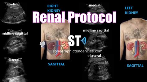 Renal Ultrasound Transverse