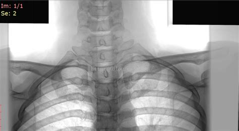 基于dcmtk和opencv的dr图像拼接dr图像 拼接 图 文件 Csdn博客