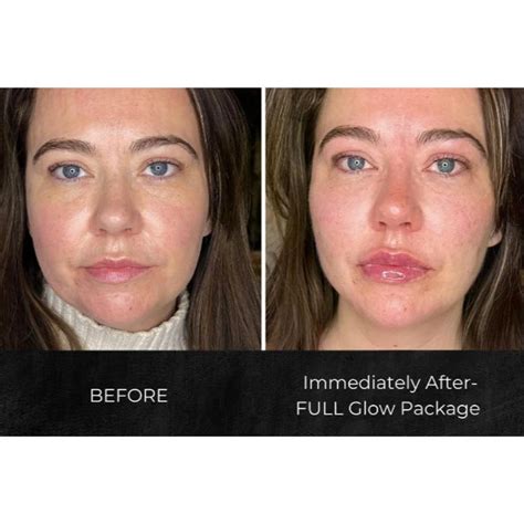 The Glow Package Snatch And Glow London
