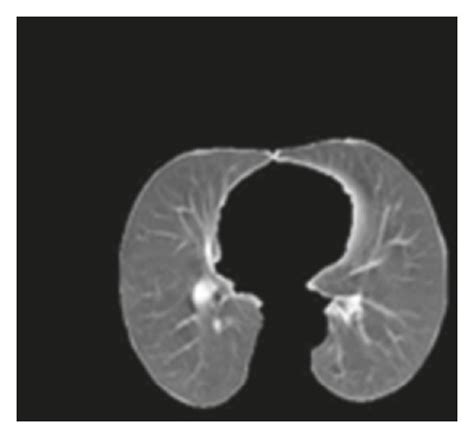 Processing Steps Of The Proposed Pipeline A Original Dicom Image