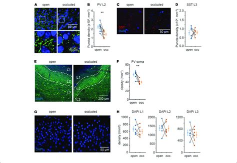 Sensory Deprivation Induced Selective Plasticity In Pv Neurons A