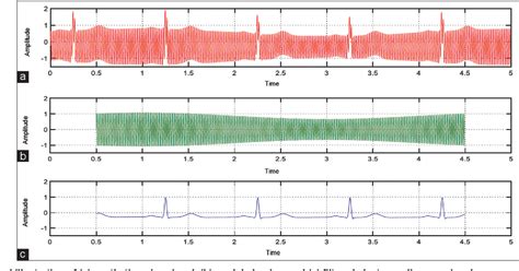 Figure 1 From Real Time Fast Fourier Transform Based Notch Filter For Single Frequency Noise