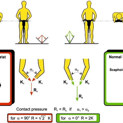 Ulnar Deviation Of The Wrist And Normal Hand Posture With Different