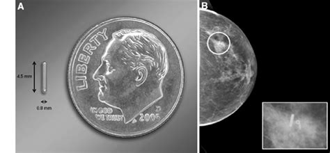 The Radioactive I 125 Seed A Positioned Next To A Dime Measuring 4 5 Download Scientific