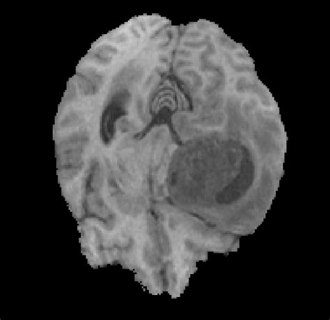 Four Different Structural Mri Modalities From Left To Right