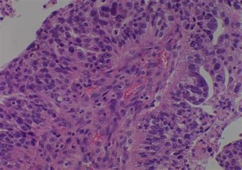 Novus Biologicals™ Human Ovary Tissue Microarray Cancer Slide Human