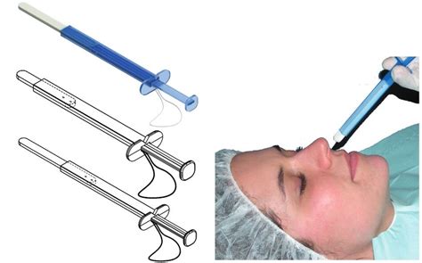 Bucomaxilofacial Prosurgery