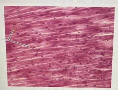 Solved Part A Identify The Highlighted Structure Perimesium Submit
