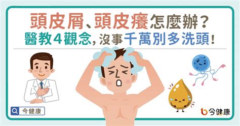 頭皮屑、頭皮癢怎麼辦？醫教4觀念，沒事千萬別多洗頭！ 今健康
