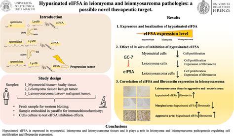 High Levels Of Hypusinated EIF5A In Leiomyoma And Leiomyosarcoma Pathologies A Possible Novel